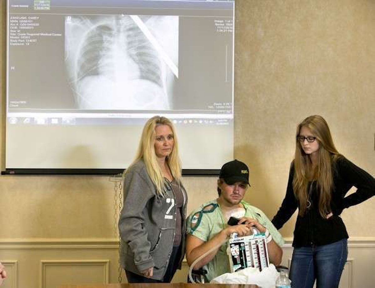 Worker survives being impaled through chest by rebar | Equipment World